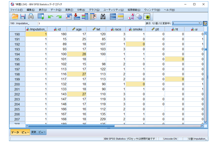 IBM SPSS Missing Values | 欠損値の分析と多重代入法 | SPSSオプション